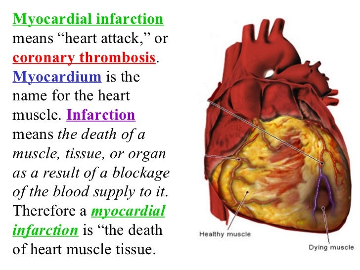 Heart Attack Plaque Blood Pressure heart-attack-plaque-blood-pressure