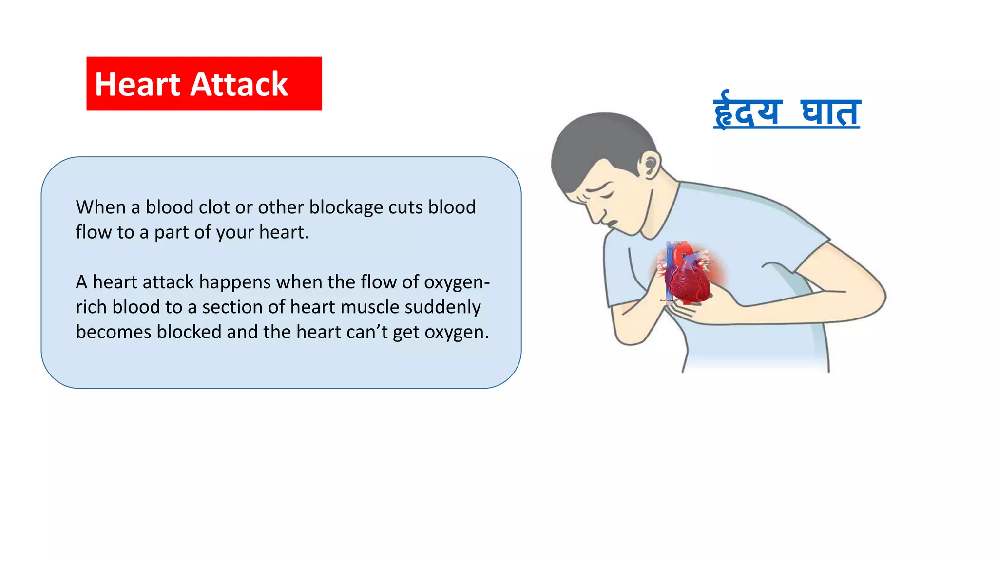Heartattack presentation | PPT