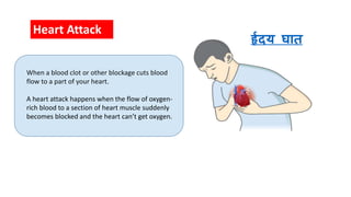 Heartattack presentation | PPT