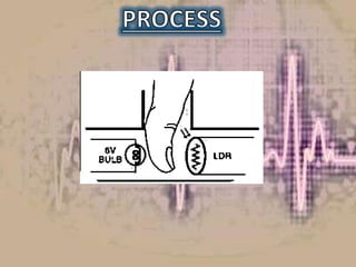 Heart beat monitoring system | PPT