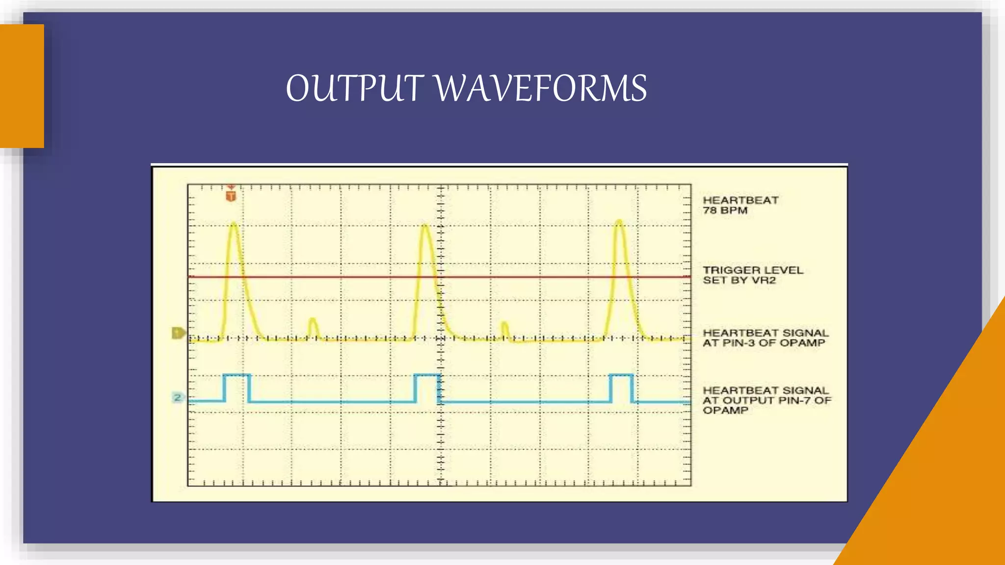 Heart beat monitoring system | PPTX