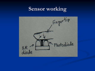 The sensor housed on the patient’s ffdgh | PPT