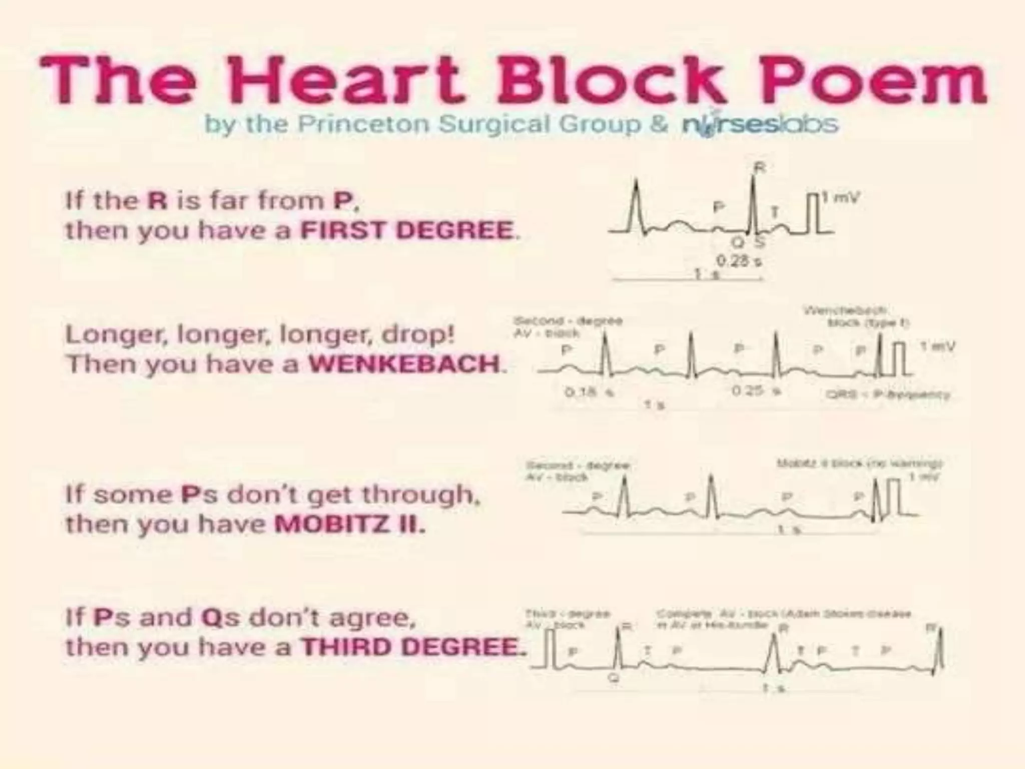 Heart block | PPTX