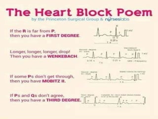 Heart block | PPTX