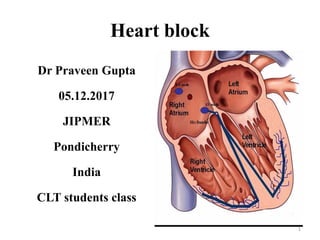 Heart Block: Types, Causes, Symptoms, And Risk Factors, 59% OFF