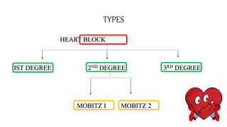 Heart block | PPTX