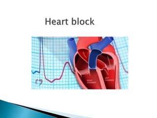 Heart block | PPTX