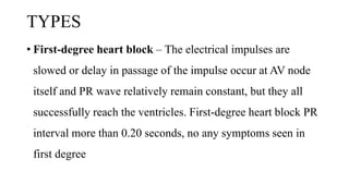 Heart block | PPTX