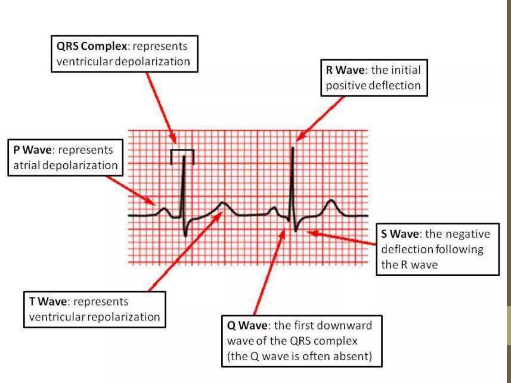 Heart block | PPTX