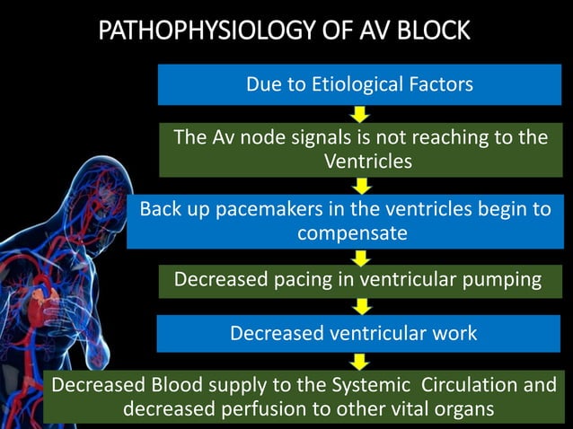 Heart block | PPT