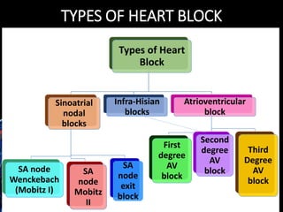 Heart block | PPT