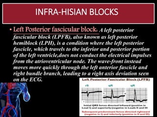 Heart block | PPT