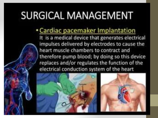 heartblock.pptx adult health nursing ppt | PPTX | Heart and ...