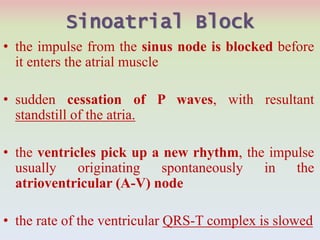 Heart block and ECG | PPTX