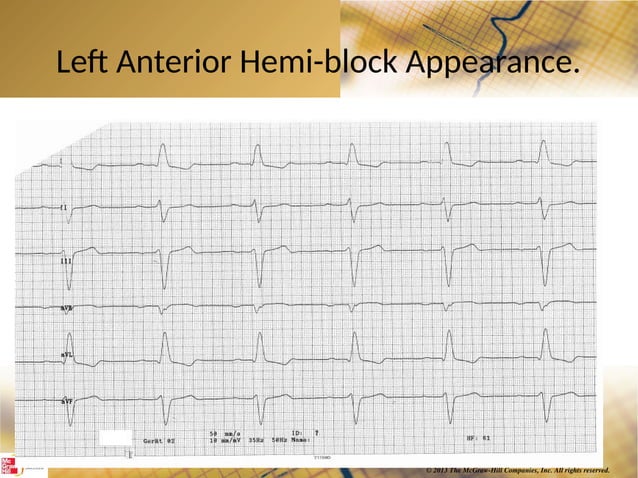 Cardiology & cardiovascular system heart block deep.pptx