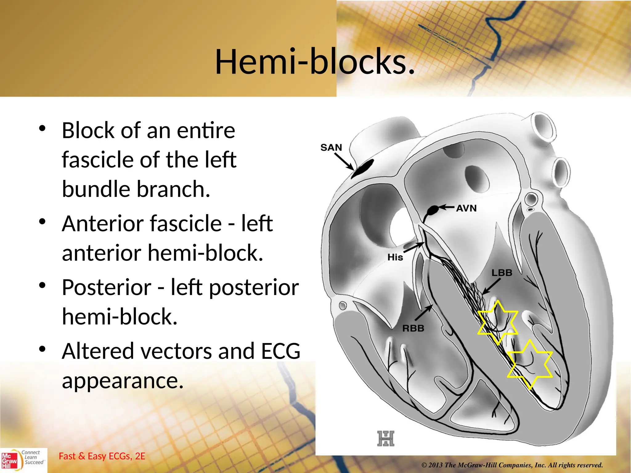 heart block deep. Cardiology & cardiovascular system | PPTX