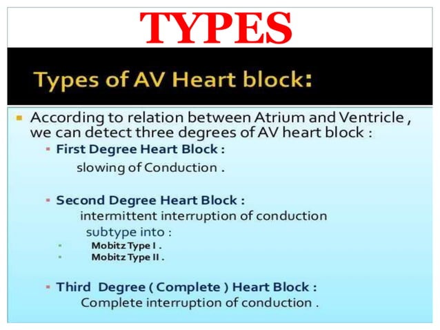 Heart block | PPTX | Heart and Cardiovascular Diseases | Diseases and ...