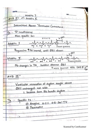 Heart blocks | PDF | Heart and Cardiovascular Diseases | Diseases and ...