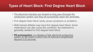Heart blocks | PPTX