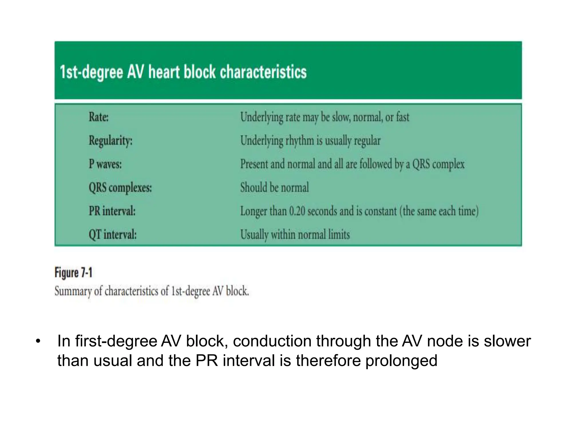 HEART BLOCKS IN ECG AND HOW TO INTEPRET IN ECG? | PPTX