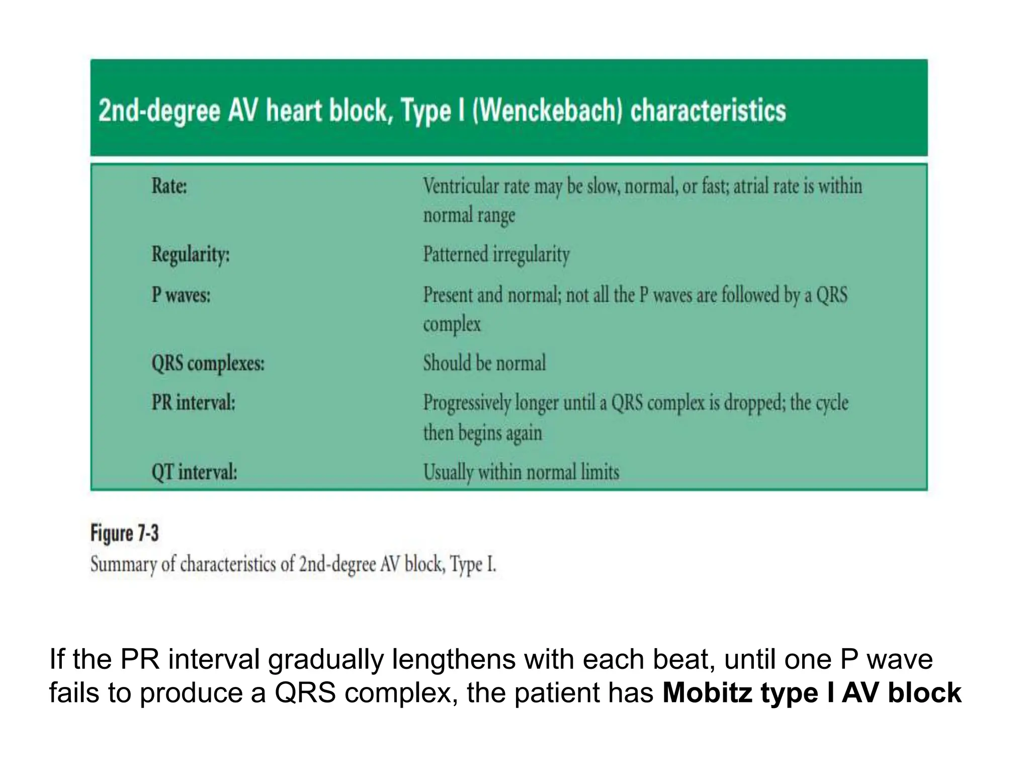 HEART BLOCKS IN ECG AND HOW TO INTEPRET IN ECG? | PPT
