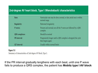 HEART BLOCKS IN ECG AND HOW TO INTEPRET IN ECG? | PPTX
