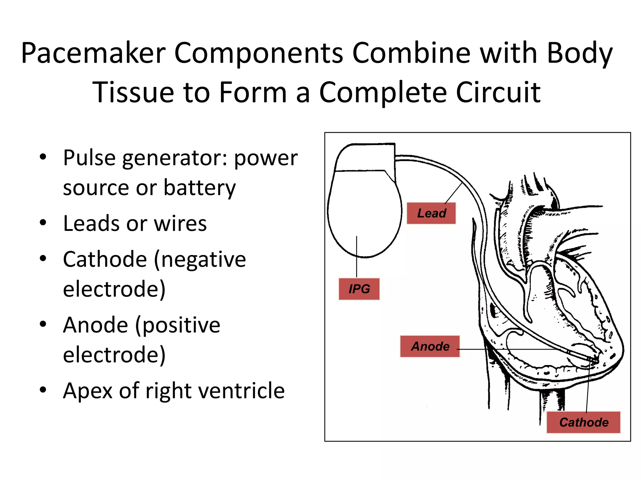 Heart blocks and pacemakers 2019 | PPTX