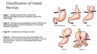 Heartburn and reflux | PPTX | Digestive Disorders | Diseases and Conditions