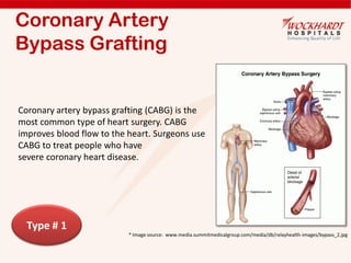 Heart care and surgeries | PDF