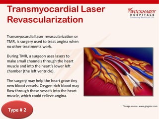 Heart care and surgeries | PDF
