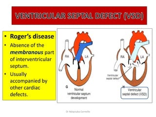 Heart Development.pptx