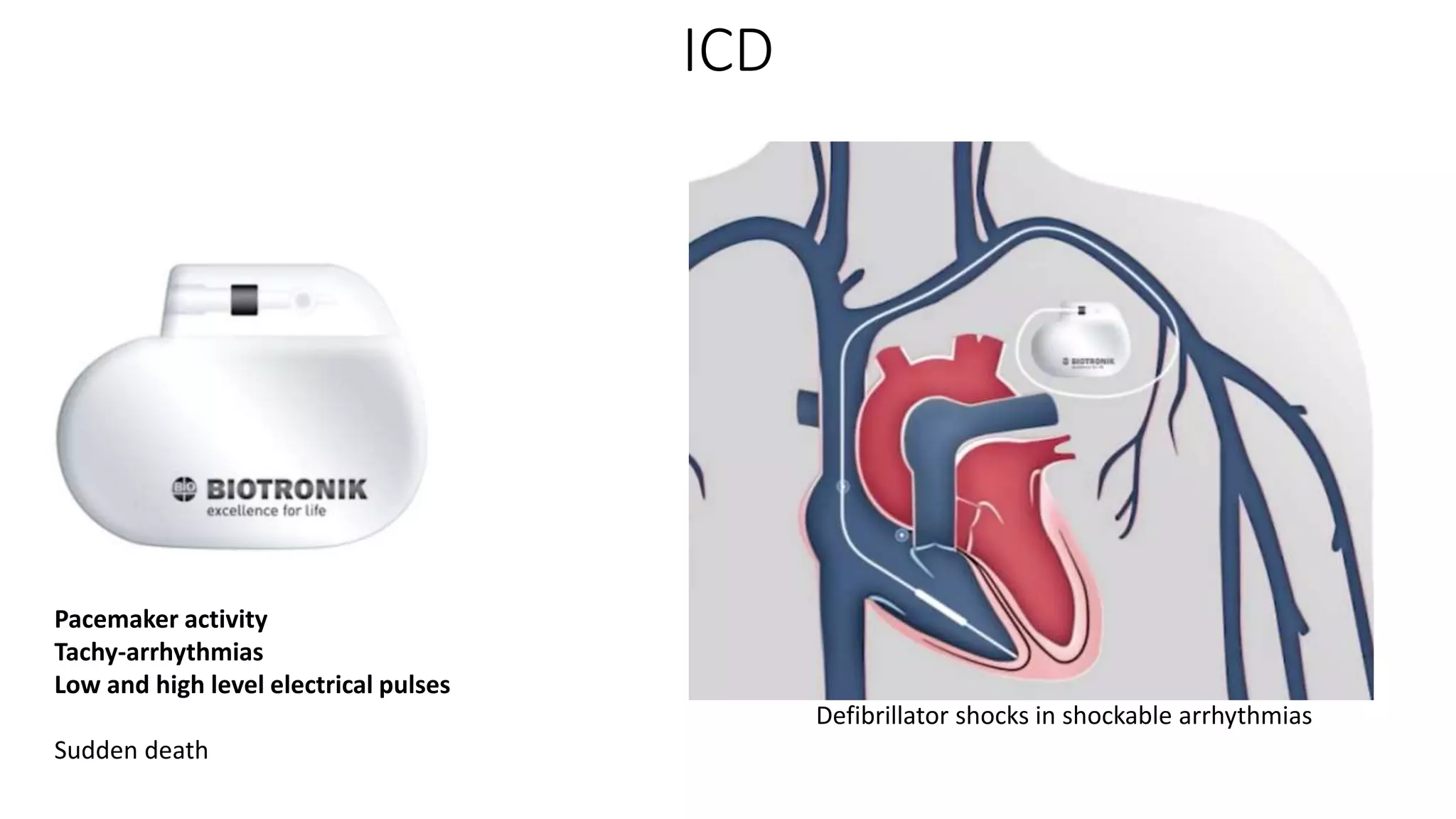 Heart devices | PPTX