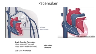 Heart devices | PPTX