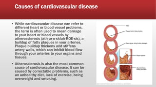 Heart disease | PPTX