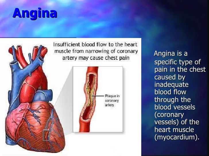 Prevention and Treatment of the Heart diseases