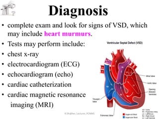 Heart disease in children...B.Sc. Nursing & GNM syllabus | PPSX
