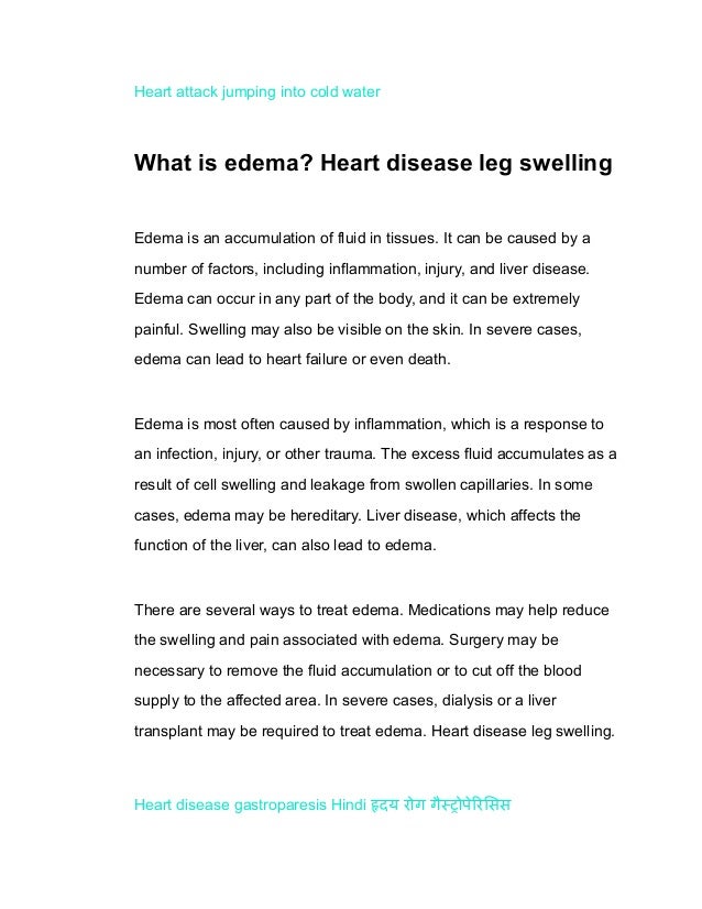 Heart Disease Leg Swelling .pdf