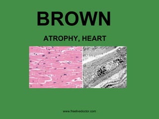Heart diseases | PPT