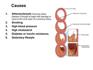 BASIC OF HEART DISEASE | PPT
