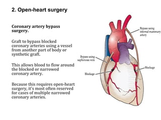 BASIC OF HEART DISEASE | PPT