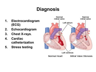 BASIC OF HEART DISEASE | PPT