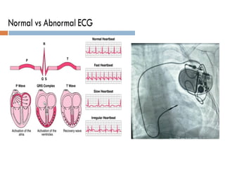 BASIC OF HEART DISEASE | PPT