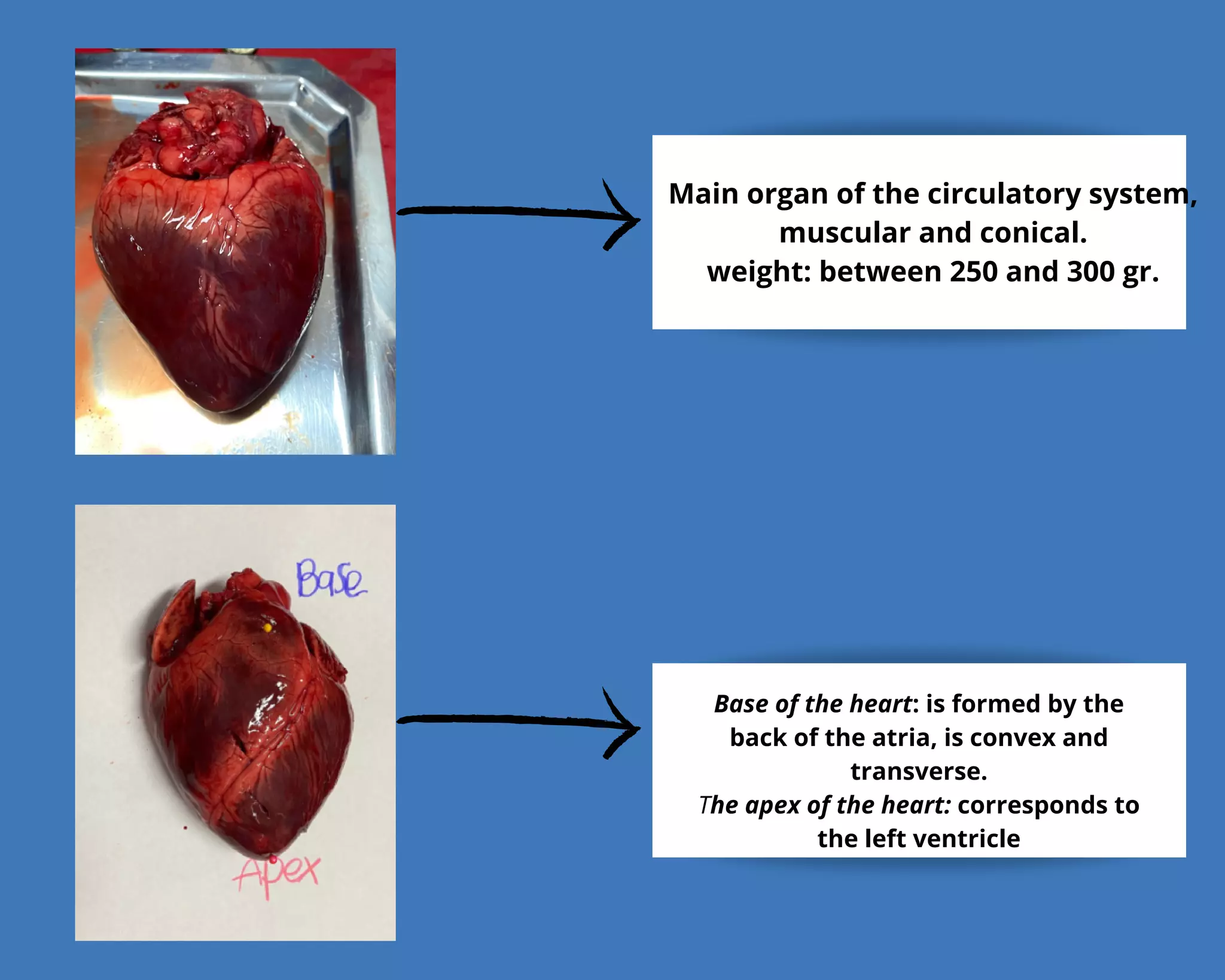 Heart disection album | PDF | Heart and Cardiovascular Diseases ...