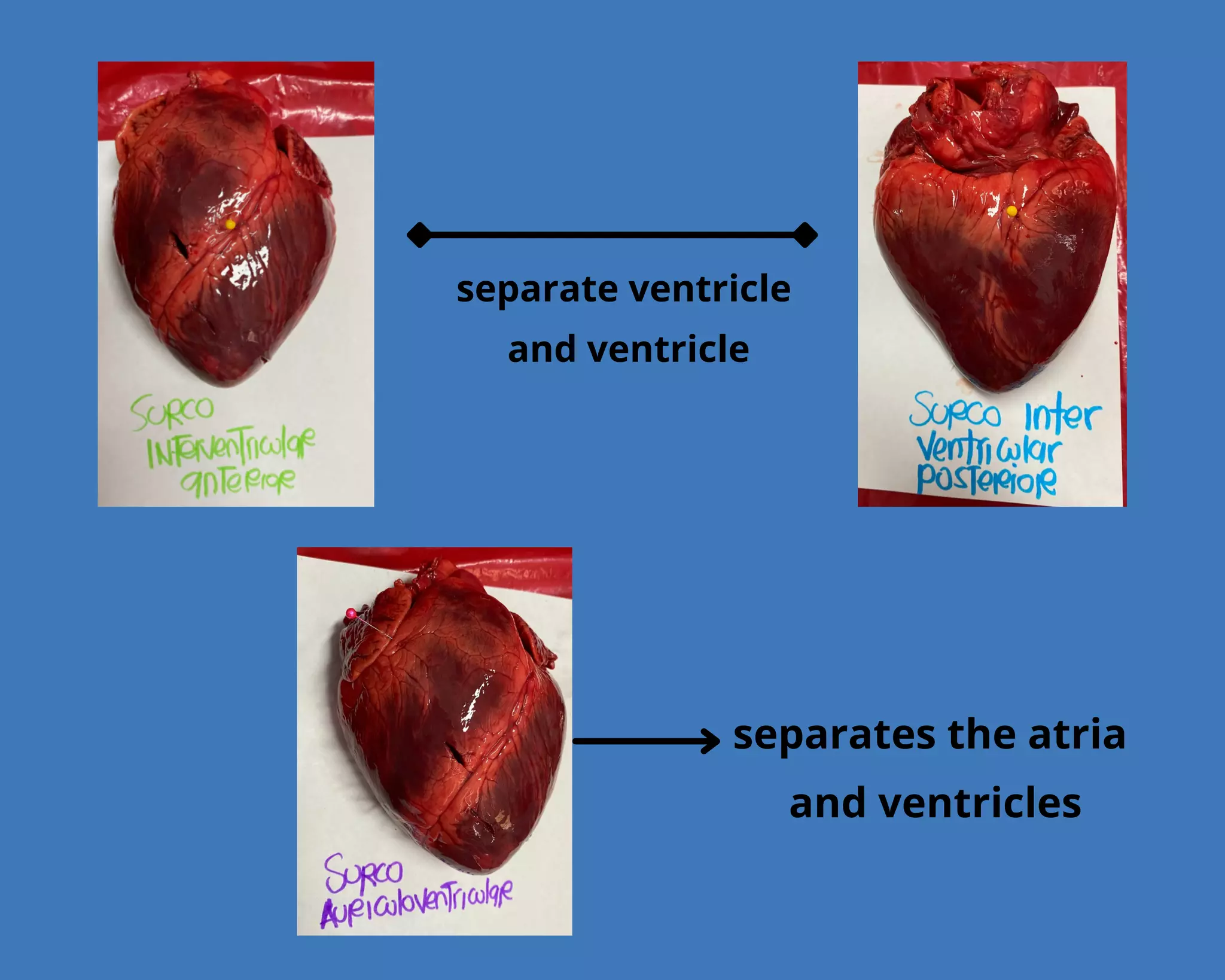 Heart disection album | PDF | Heart and Cardiovascular Diseases ...