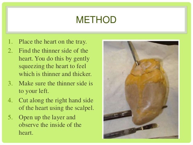 heartdissectionprac
