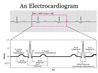 Heart excitation | PPT