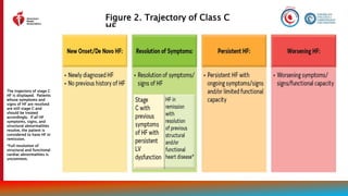 Heart Failture Guidelines Finalized.pptx