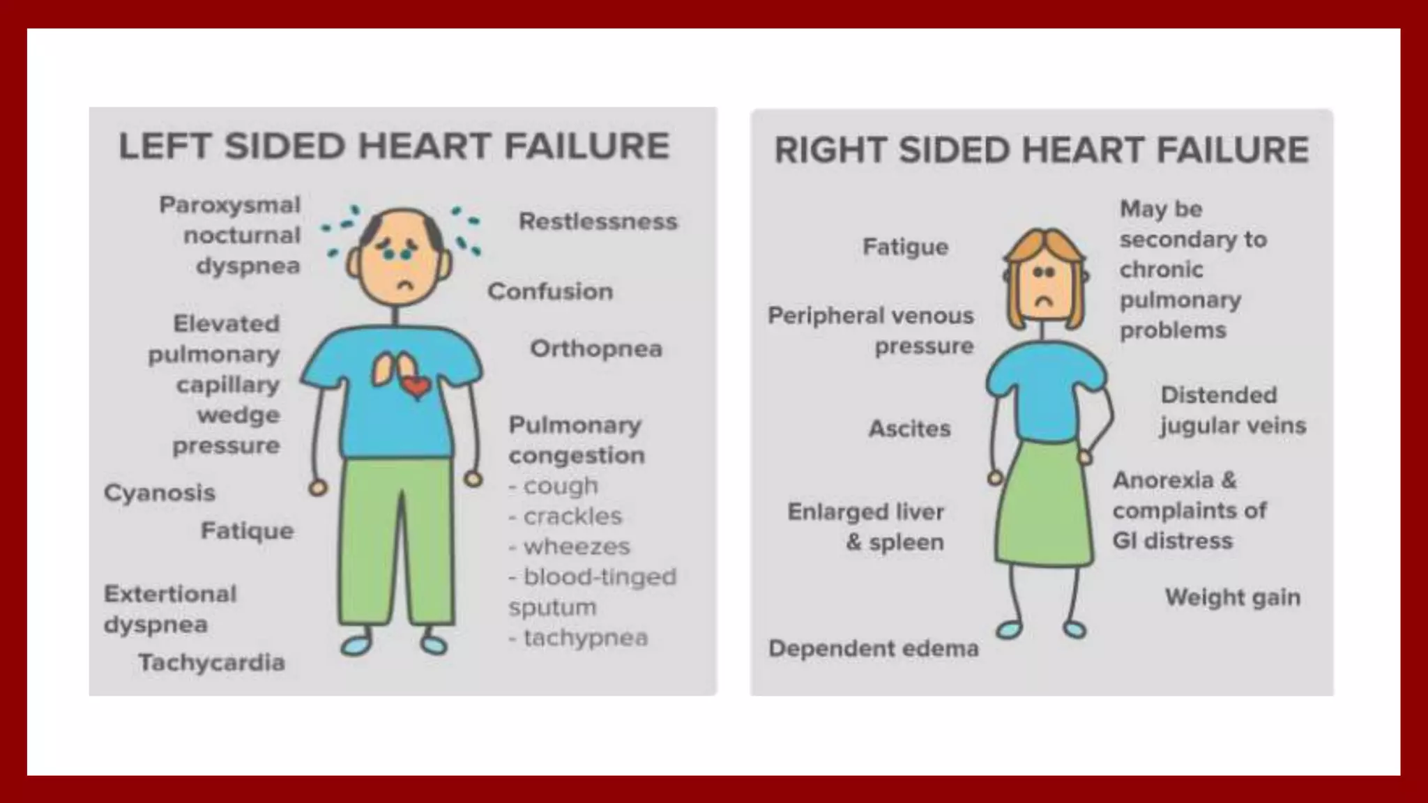 Heart Failure (Case Presentation) | PPTX
