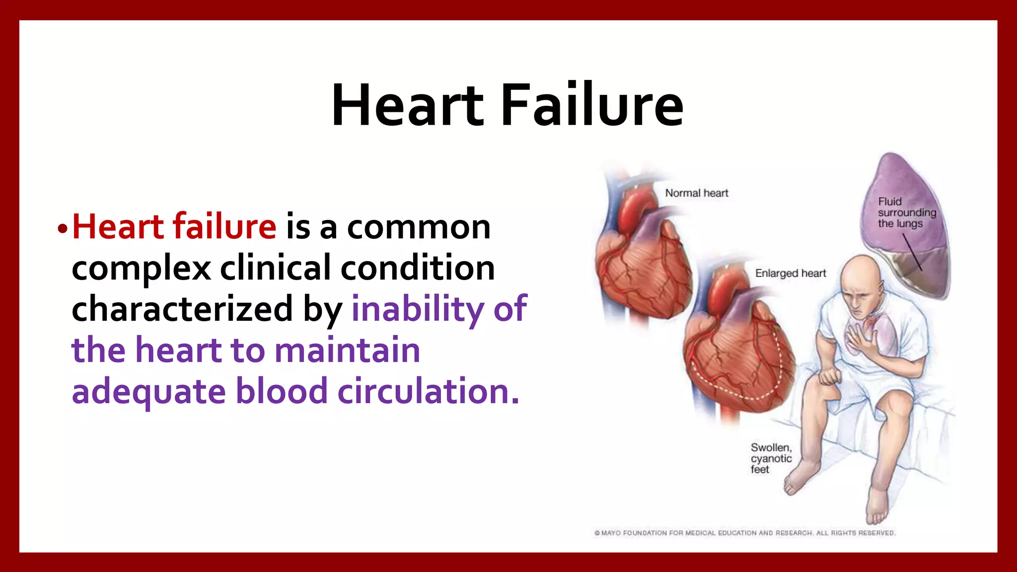 Heart Failure (Case Presentation) | PPTX