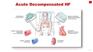 Management of Heart failure | PPTX